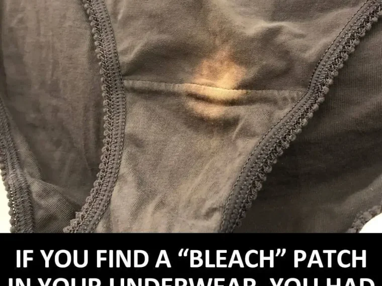 If you find a “bleach” patch in your underwear, you had better know ...